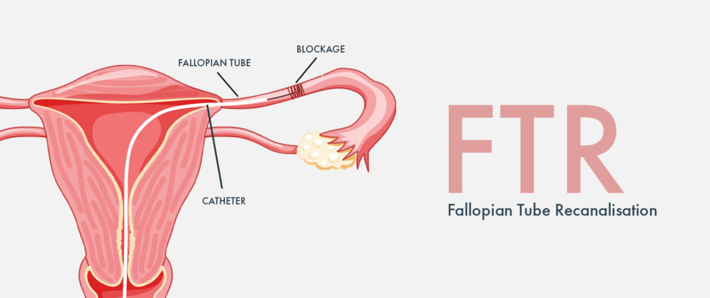 FTR – MIC Radiology Group