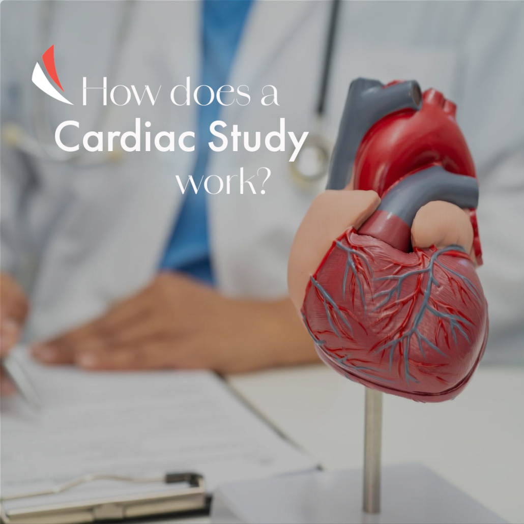How does a Cardiac Study work? – MIC Radiology Group