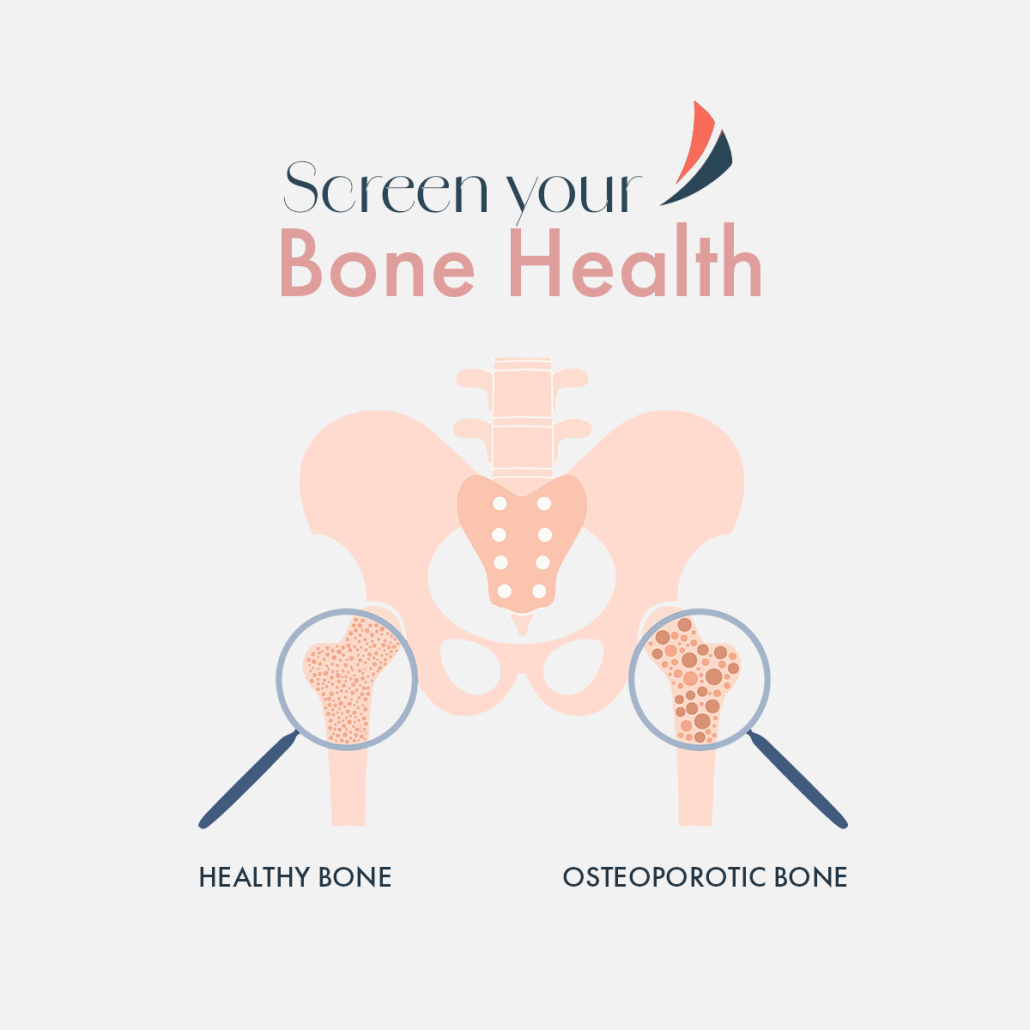 Screen Your Bone Health – MIC Radiology Group