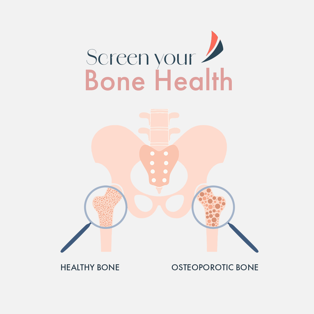 Screen Your Bone Health – MIC Radiology Group