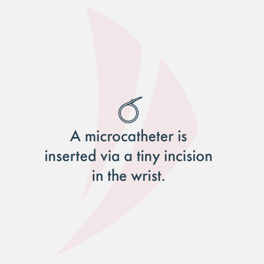 How is UFE performed? – MIC Radiology Group